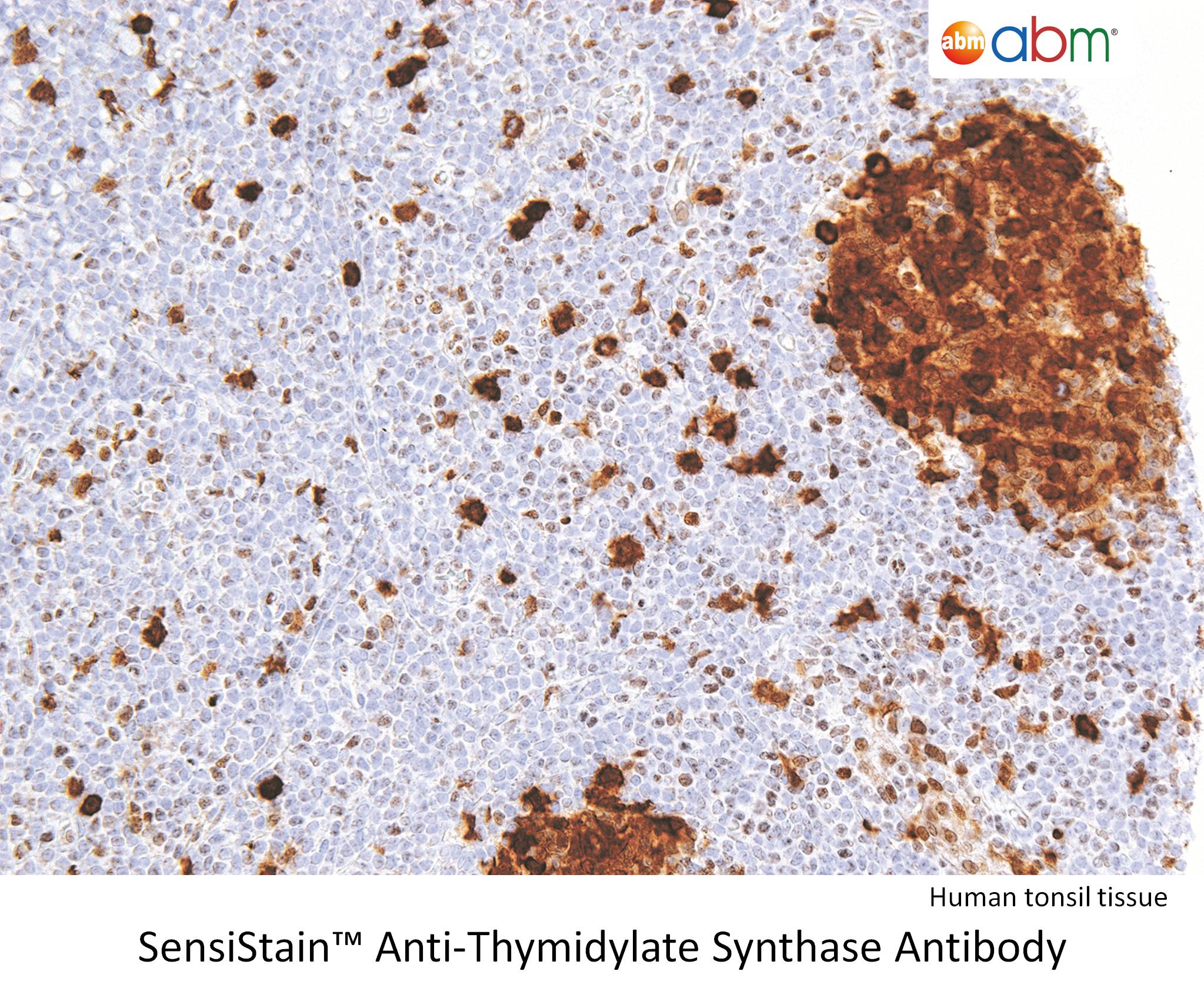 SensiStain™ Anti-Thymidylate Synthase Antibody | Applied Biological ...