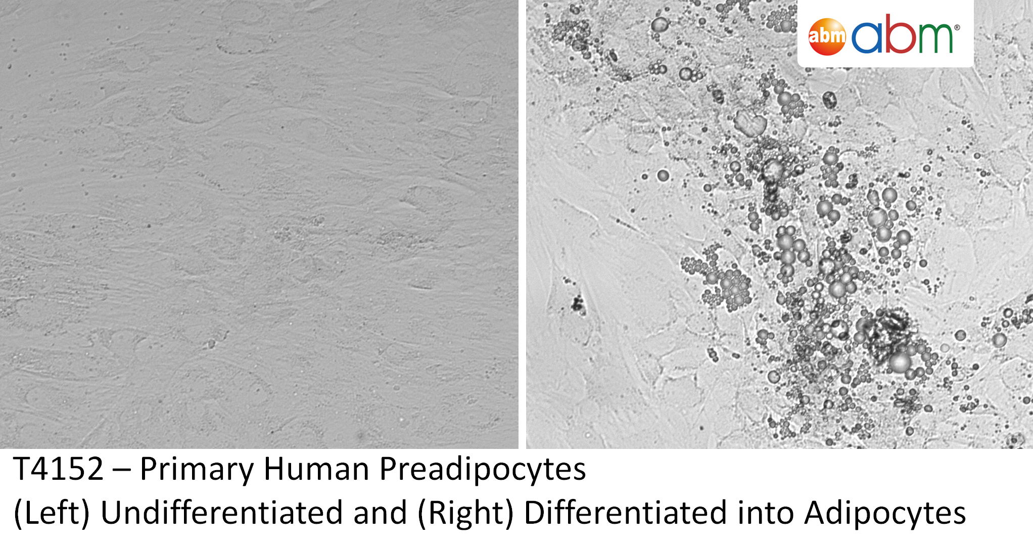 Primary Human Preadipocytes | Applied Biological Materials Inc.